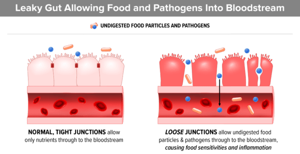 Top Reasons to Implement a GFCF Diet - The Autism Community in Action