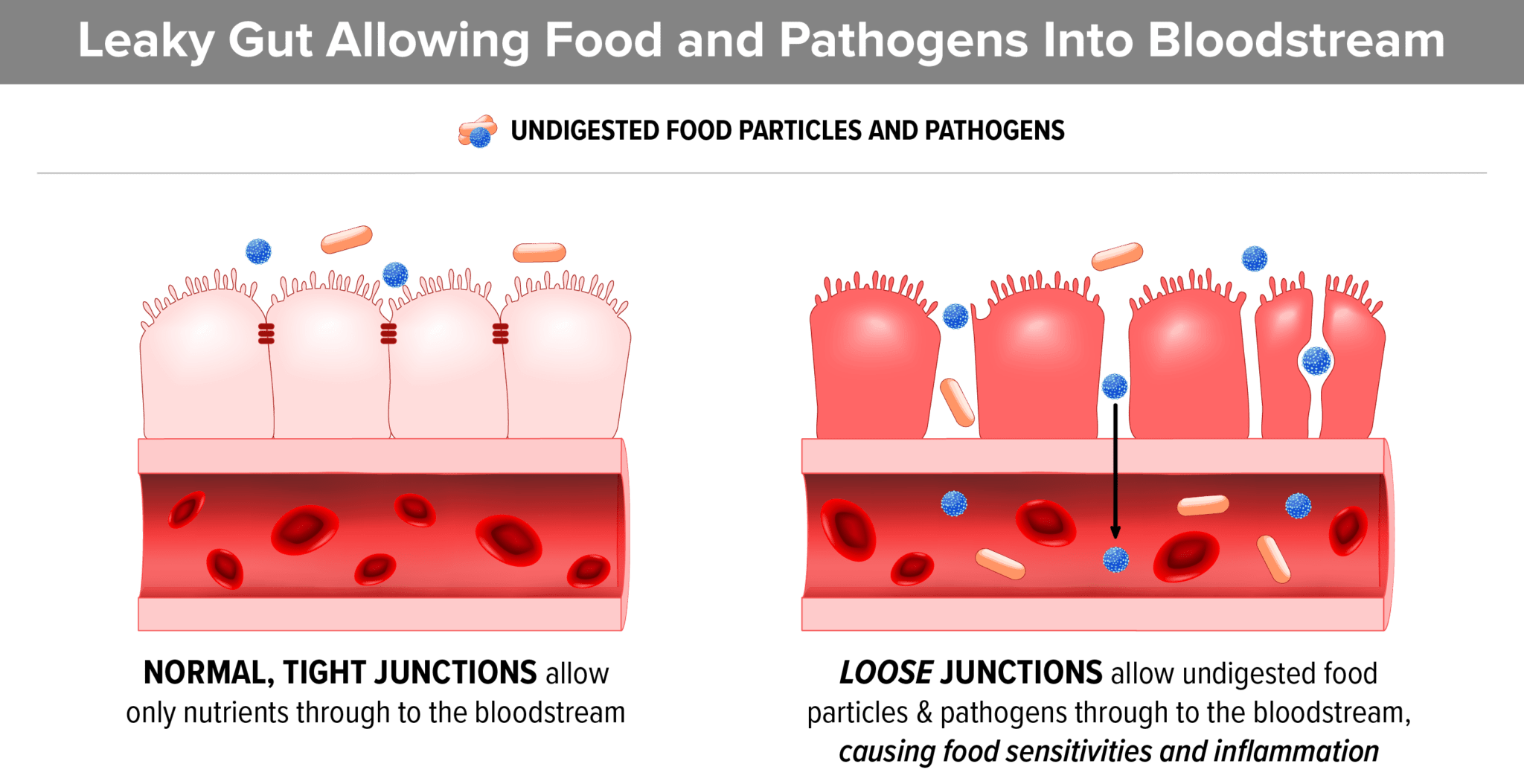 Top Reasons to Implement a GFCF Diet - The Autism Community in Action